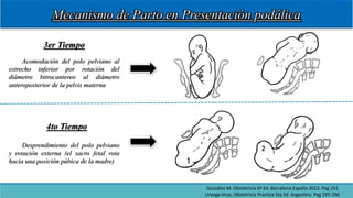 Parto podalico | PPTX