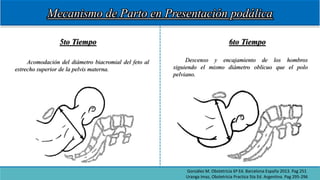 Parto podalico | PPTX
