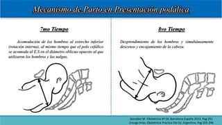 Parto podalico | PPTX