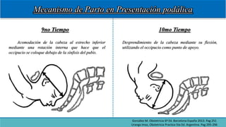Parto podalico | PPTX