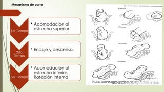 parto podalico. Tecnicas y mecanismo del parto | PPTX