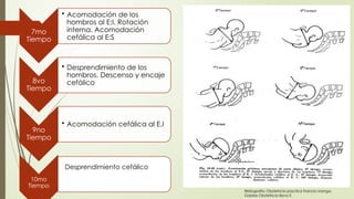 parto podalico. Tecnicas y mecanismo del parto | PPTX