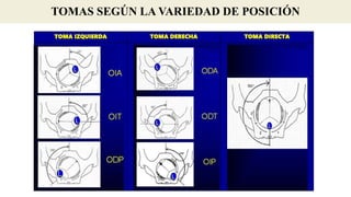 PARTO VAGINAL INSTRUMENTADO- SUBGRUPO 3.pptx