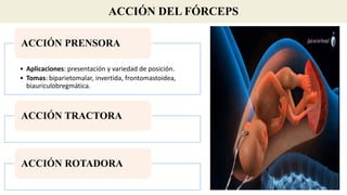 PARTO VAGINAL INSTRUMENTADO- SUBGRUPO 3.pptx