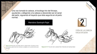 PARTO VAGINAL INSTRUMENTADO R1 SALAS.pptx