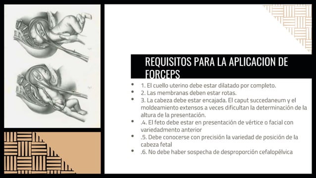 PARTO VAGINAL INSTRUMENTADO R1 SALAS.pptx