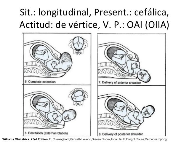 Parto y trabajo de parto