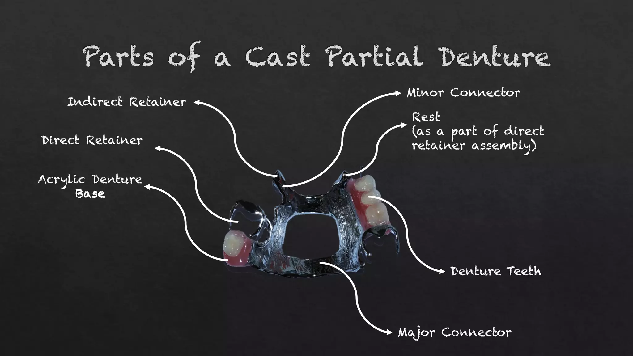Parts of Cast Partial Dentures | PDF