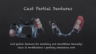 Parts of Cast Partial Dentures | PDF