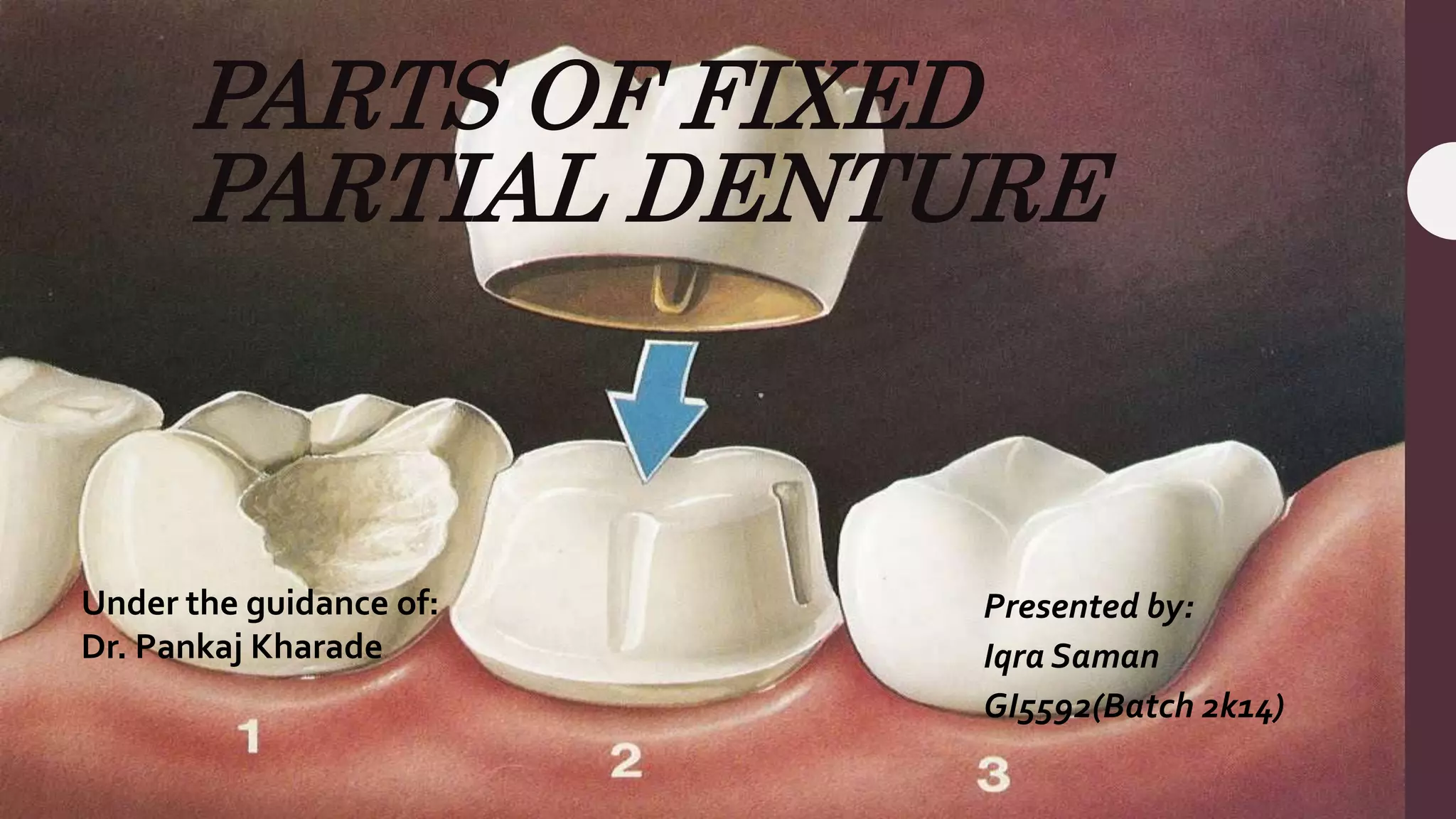 Parts of fixed partial denture | PPTX