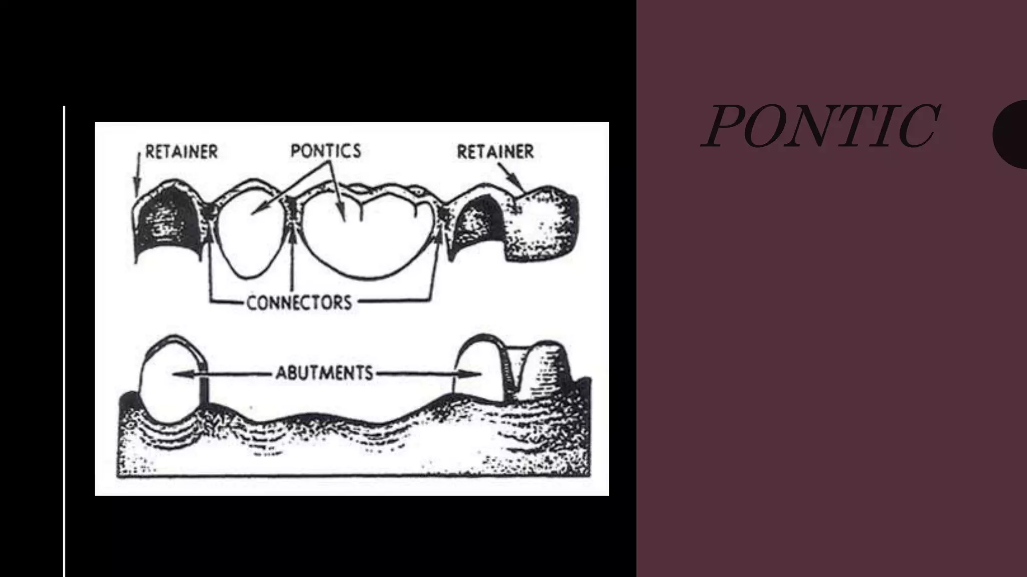 Parts of fixed partial denture | PPTX