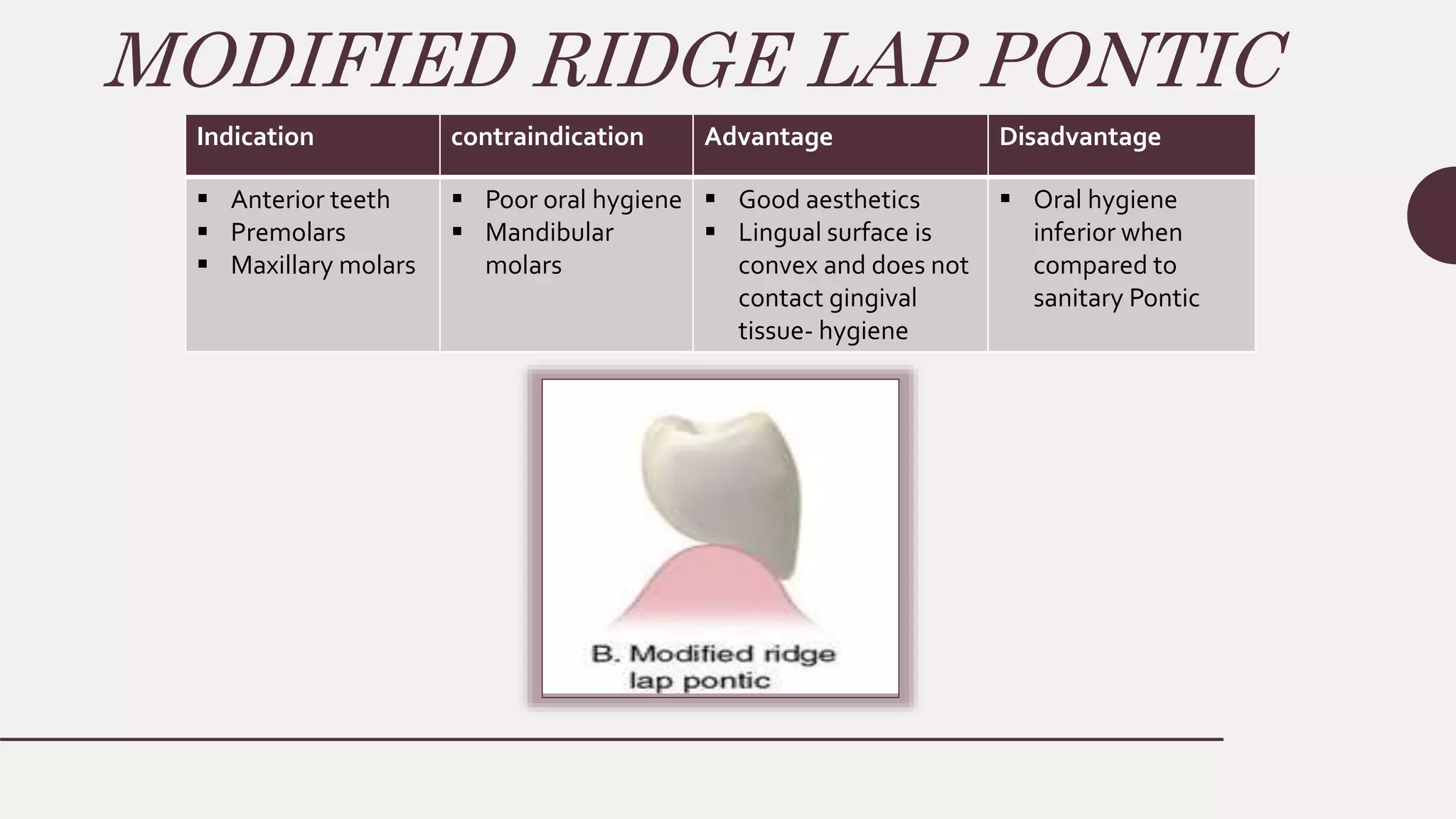Parts of fixed partial denture | PPTX