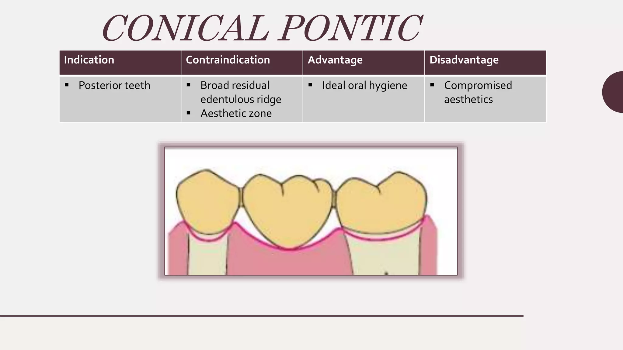 Parts of fixed partial denture | PPTX