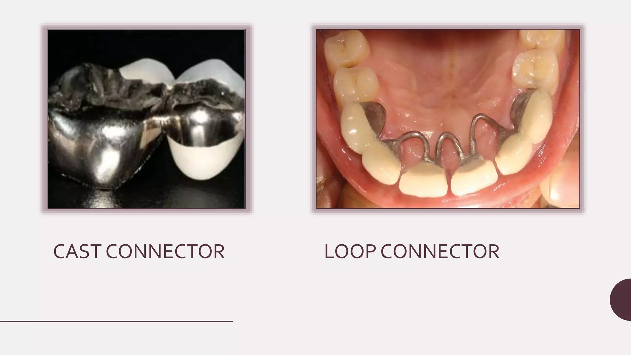 Parts of fixed partial denture | PPTX
