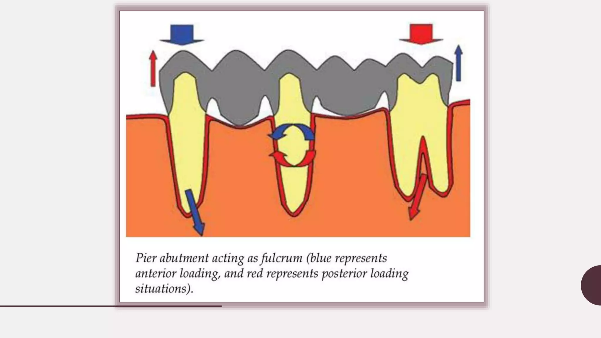 Parts of fixed partial denture | PPTX