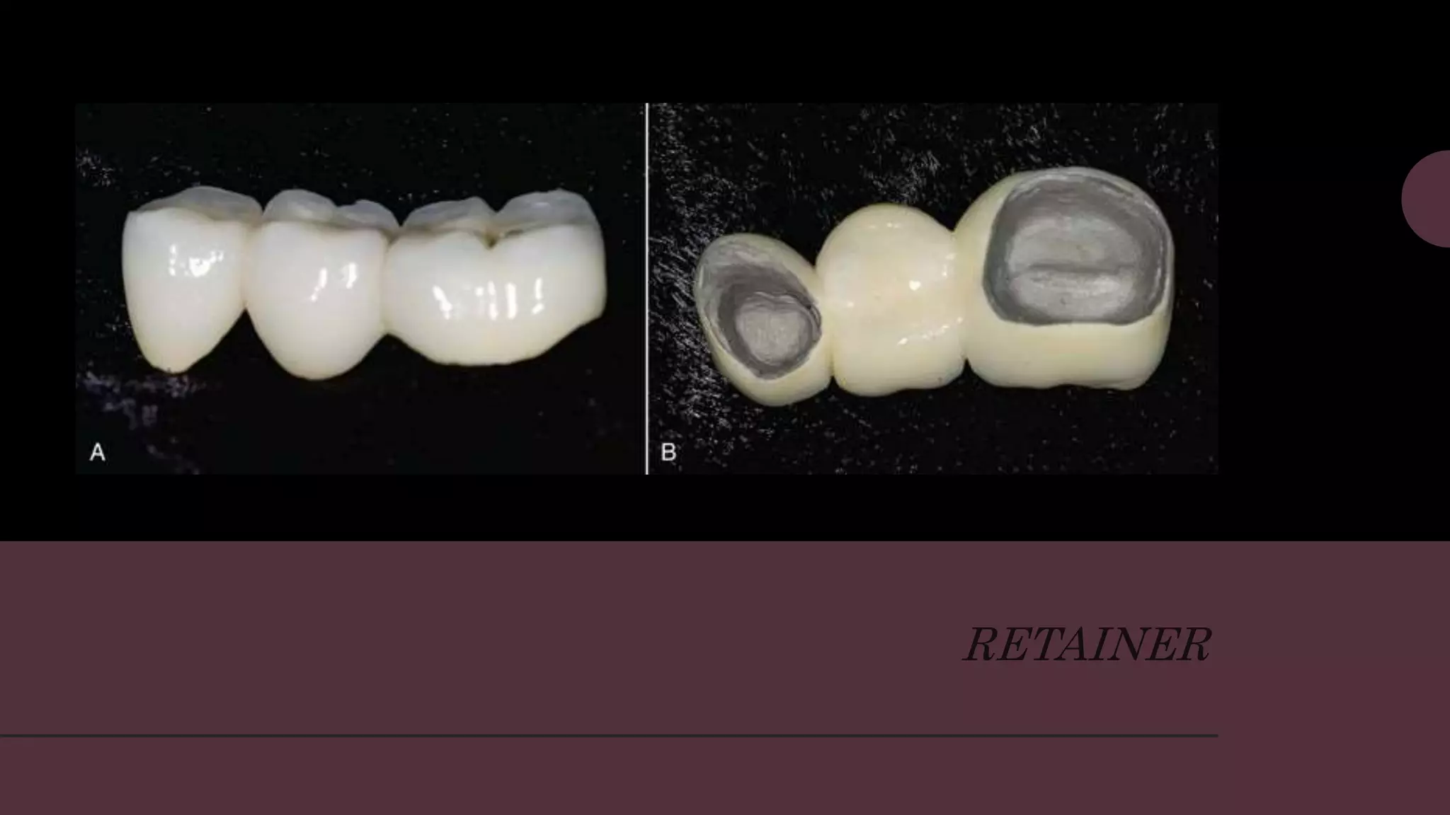 Parts of fixed partial denture | PPTX