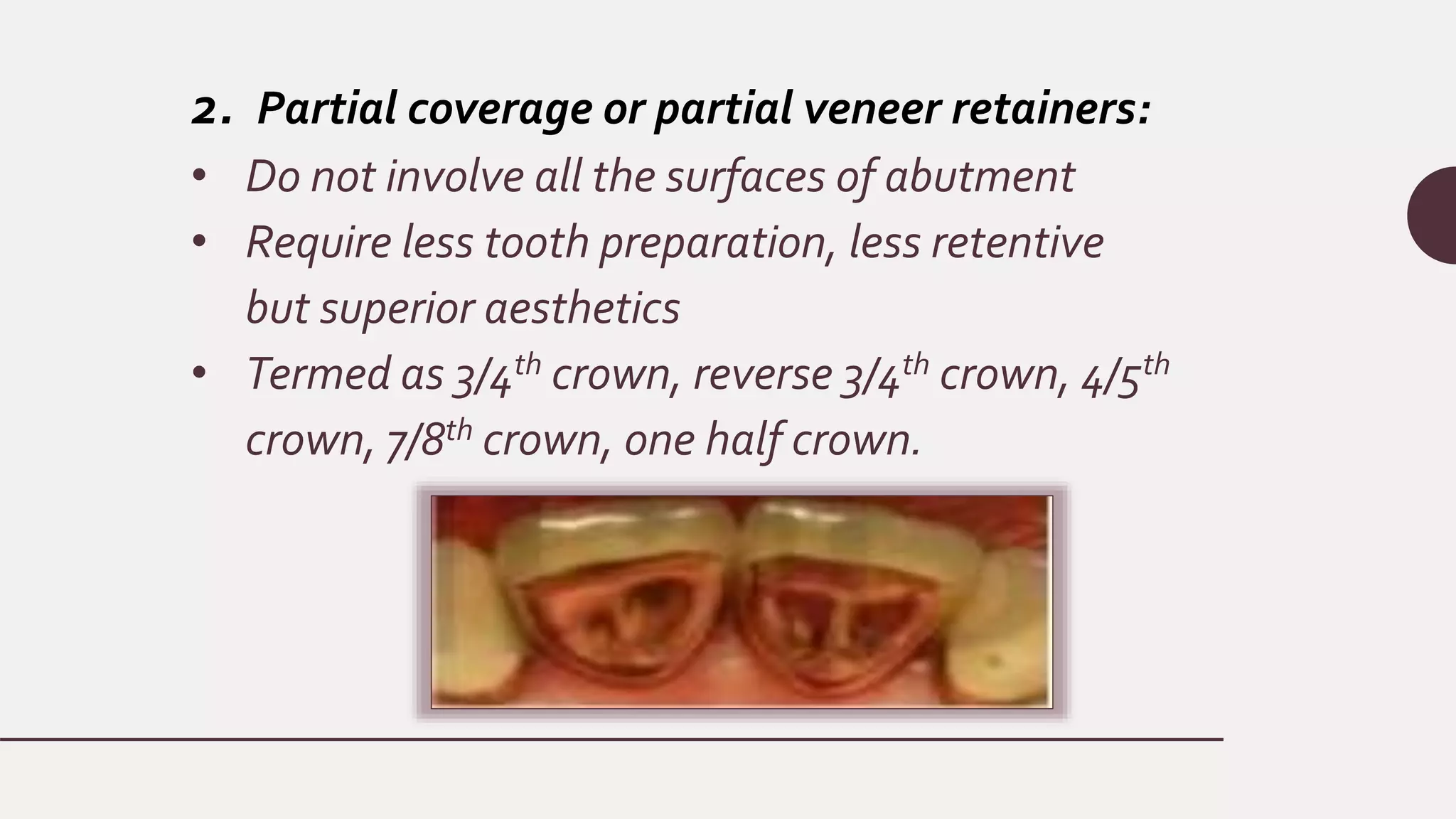 Parts of fixed partial denture | PPTX