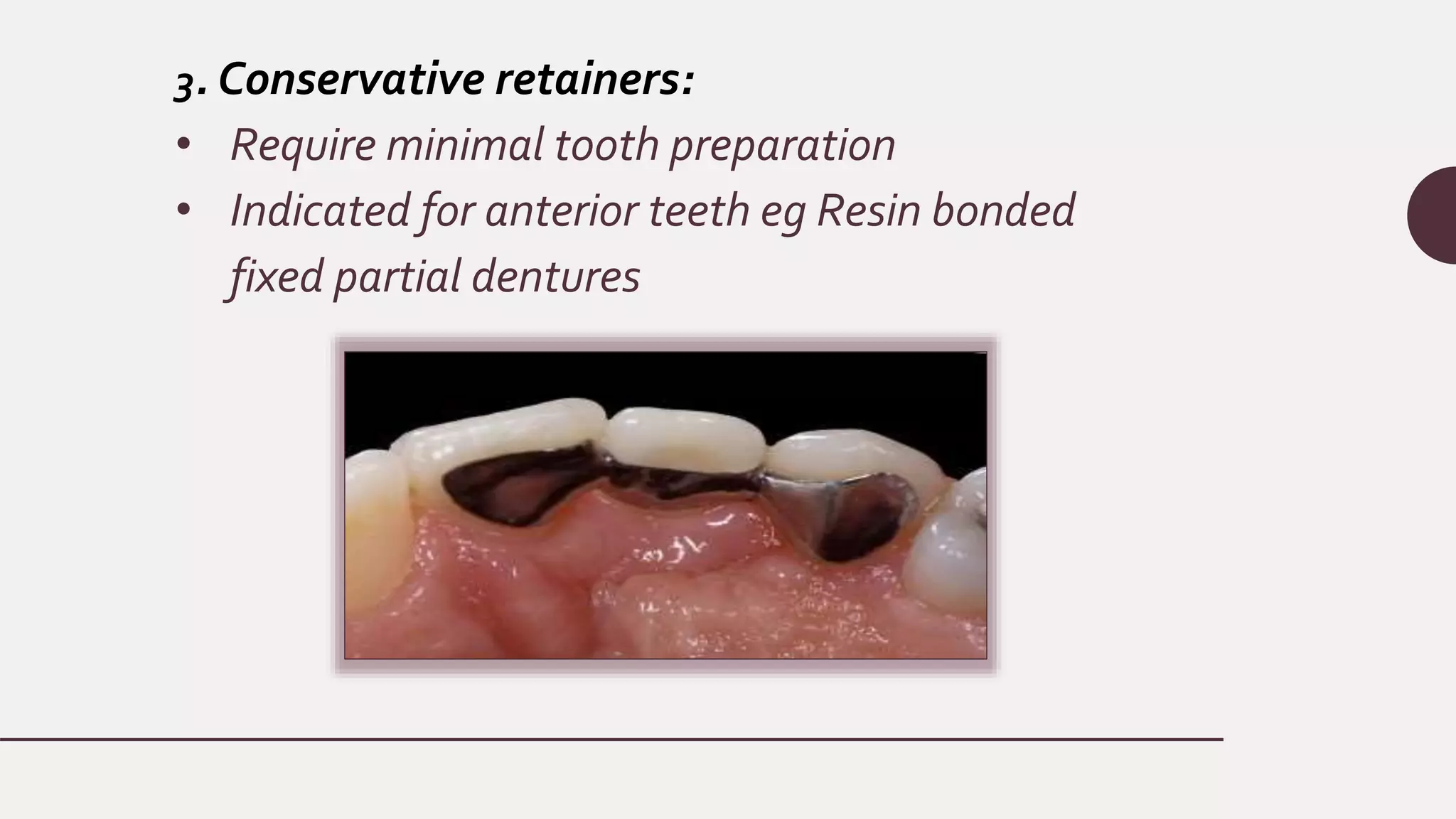 Parts of fixed partial denture | PPTX