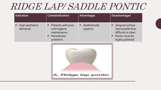 Parts of fixed partial denture | PPTX