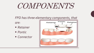Parts of fixed partial denture | PPTX