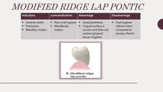 Parts of fixed partial denture | PPTX