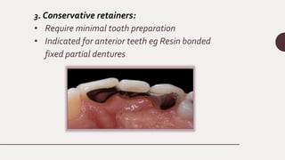 Parts of fixed partial denture | PPTX