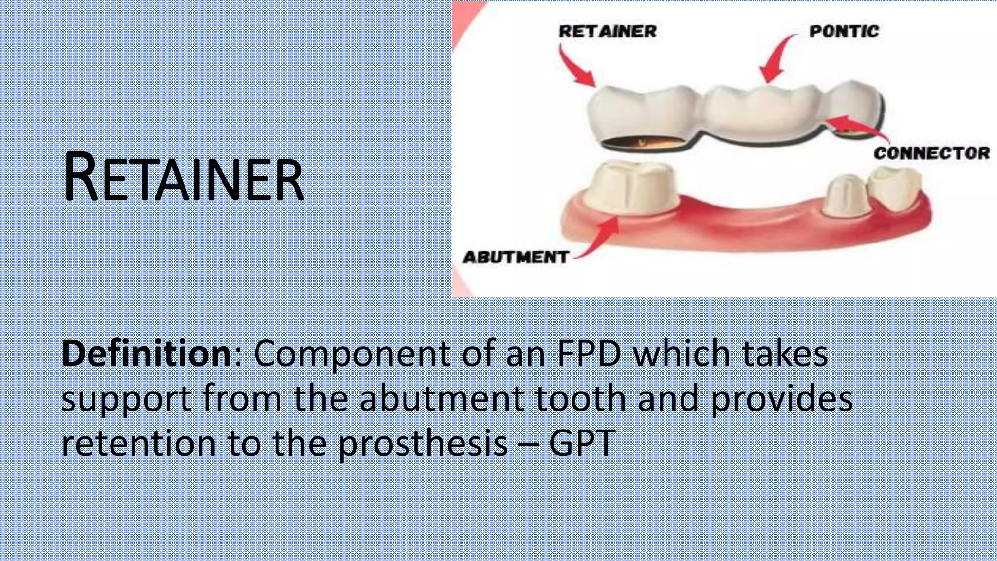 PARTS OF FIXED PARTIAL DENTURE.pptx