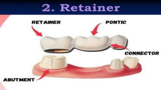 PARTS OF FIXED PARTIAL DENTURE.pptx