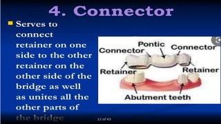 PARTS OF FIXED PARTIAL DENTURE.pptx