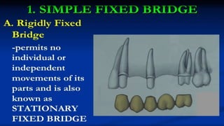 PARTS OF FIXED PARTIAL DENTURE.pptx
