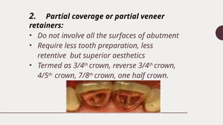 Parts of fixed partial denture gege.pptx