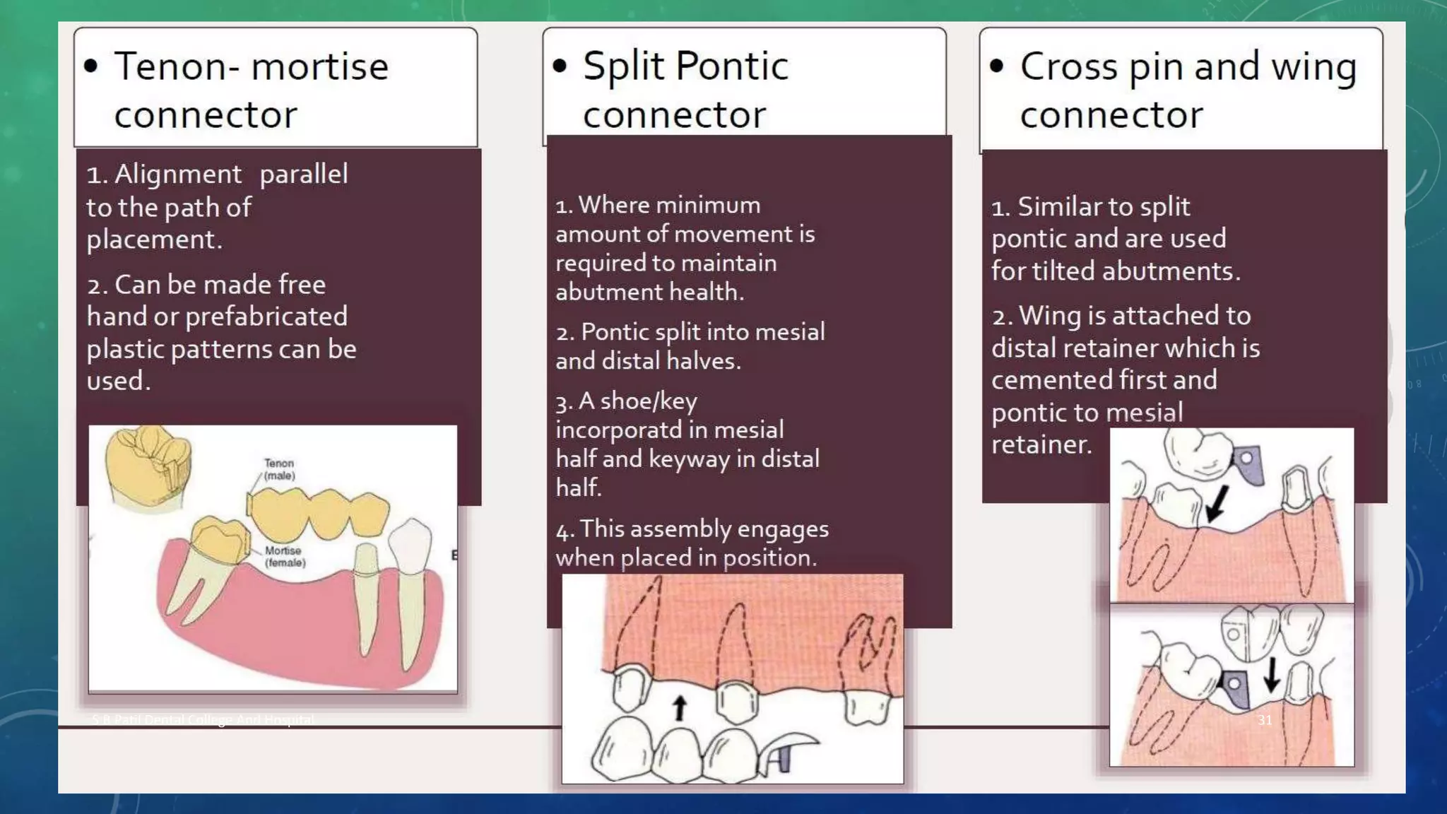 COMPONENTS OF FIXED PARTIAL DENTURE | PPTX