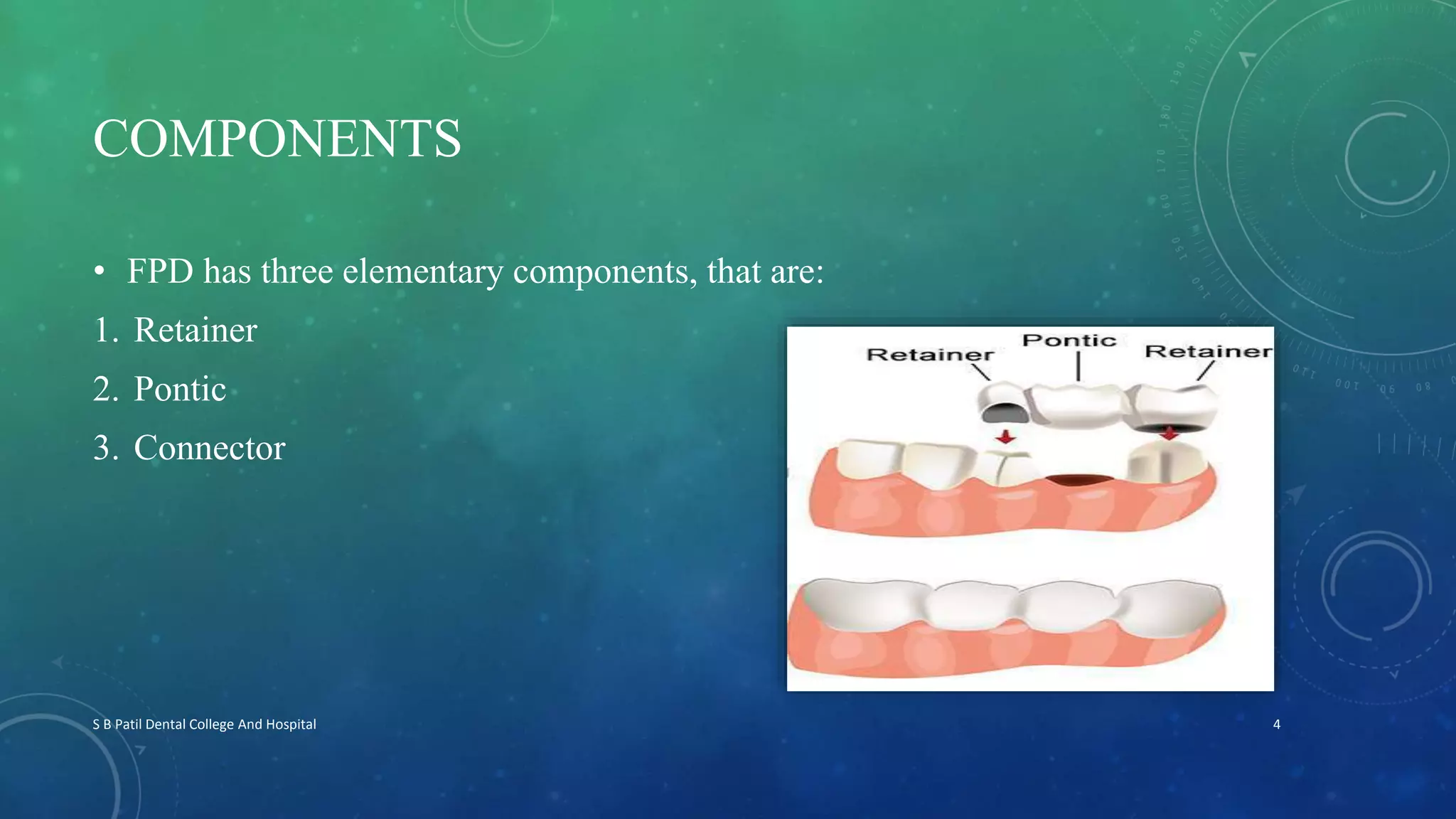 COMPONENTS OF FIXED PARTIAL DENTURE | PPTX