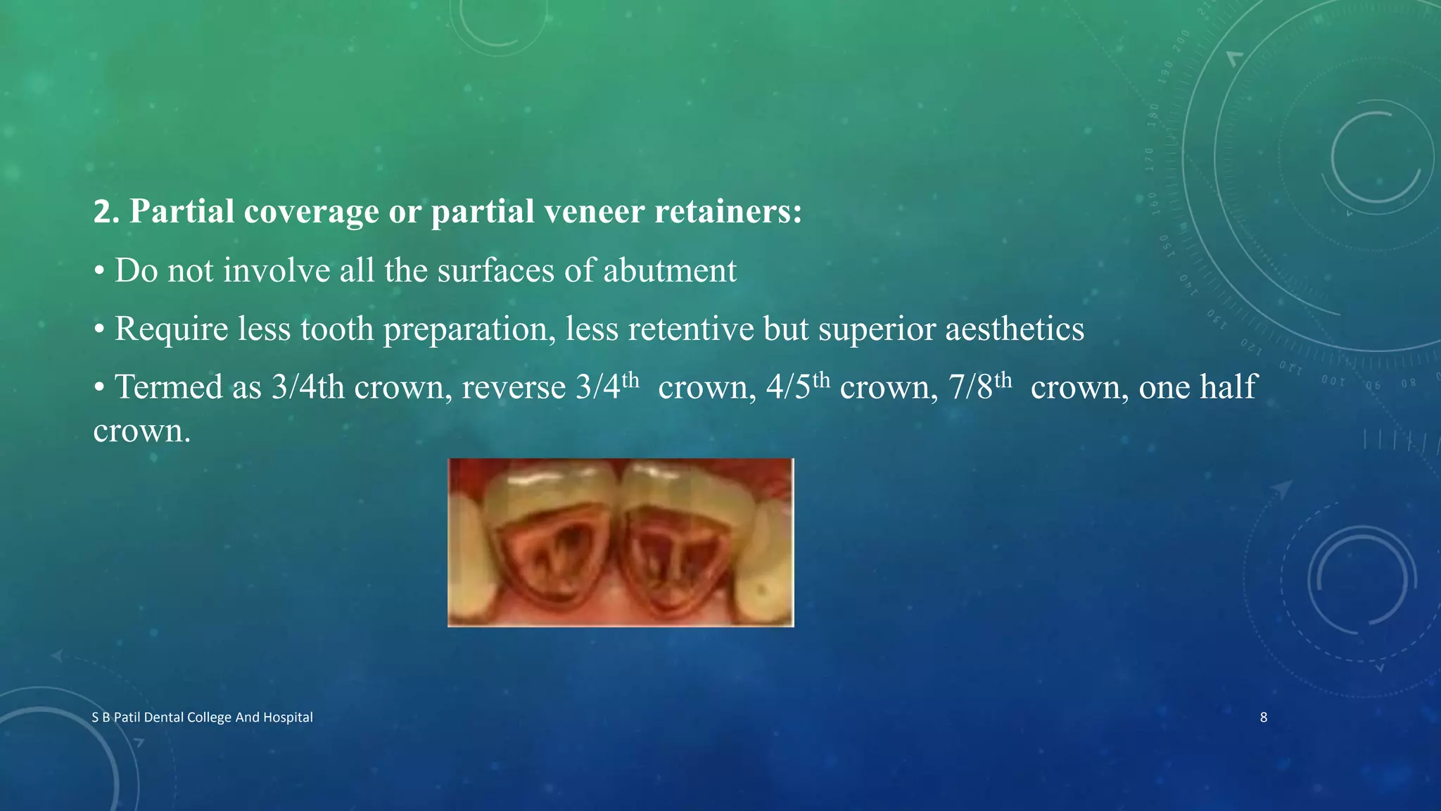 COMPONENTS OF FIXED PARTIAL DENTURE | PPTX