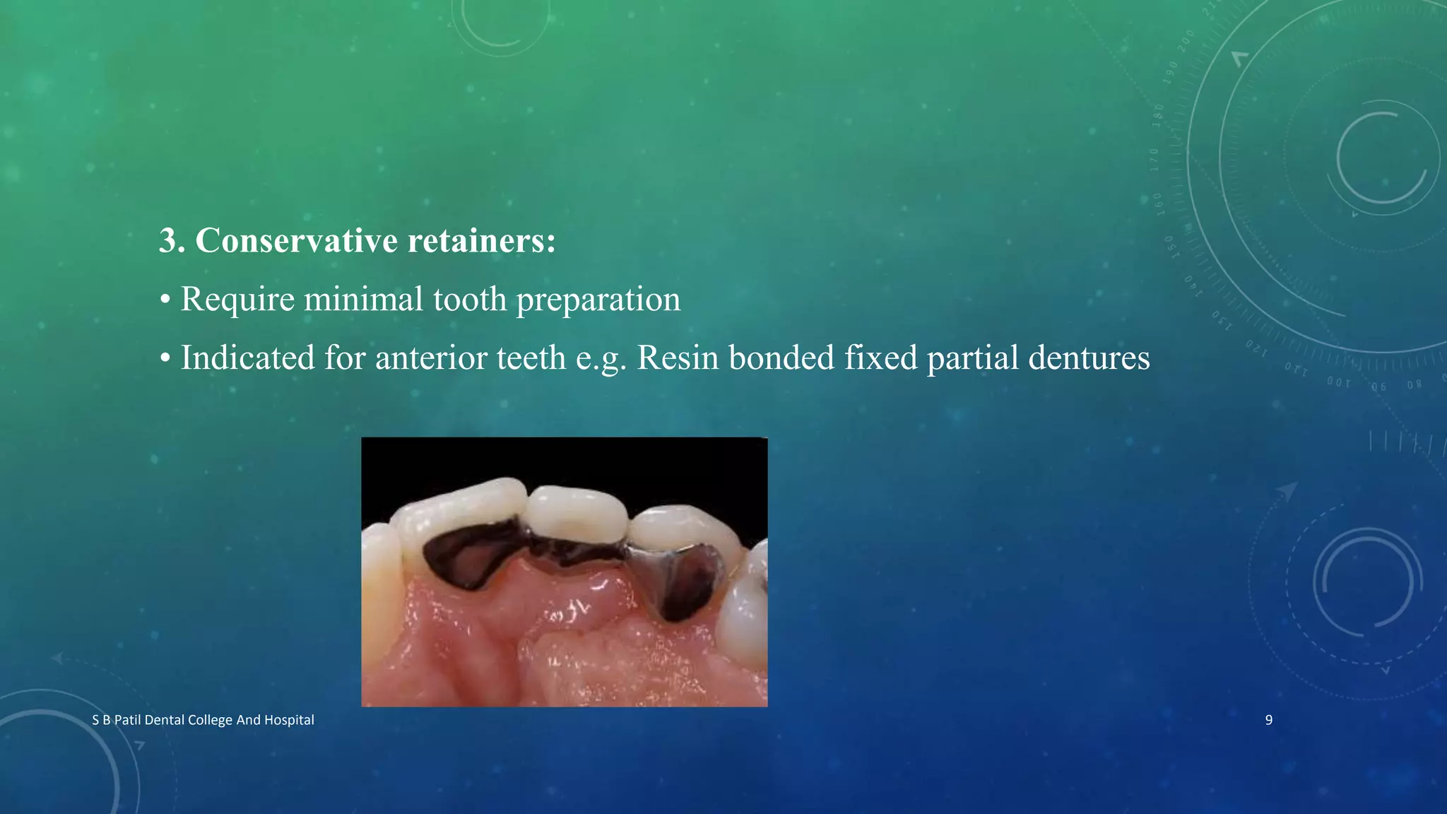COMPONENTS OF FIXED PARTIAL DENTURE | PPTX