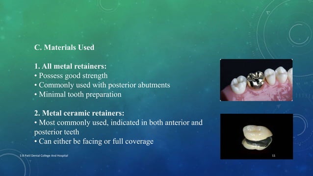 COMPONENTS OF FIXED PARTIAL DENTURE | PPT