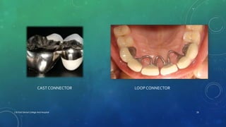 COMPONENTS OF FIXED PARTIAL DENTURE | PPT