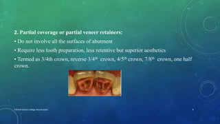 COMPONENTS OF FIXED PARTIAL DENTURE | PPTX