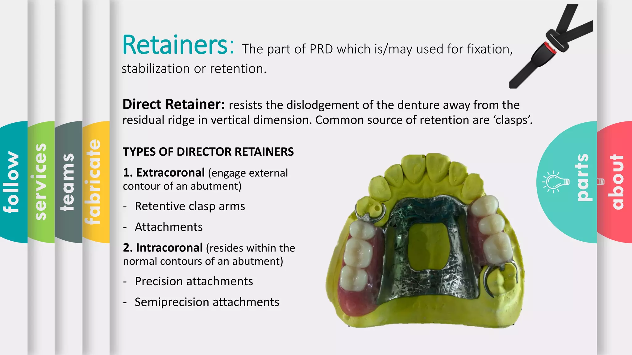 Parts of Removable Partial Denture by FARYAL SAEED ABDAL | PDF
