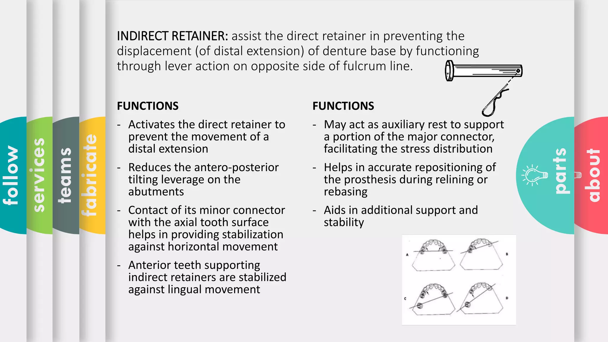 Parts of Removable Partial Denture by FARYAL SAEED ABDAL | PDF