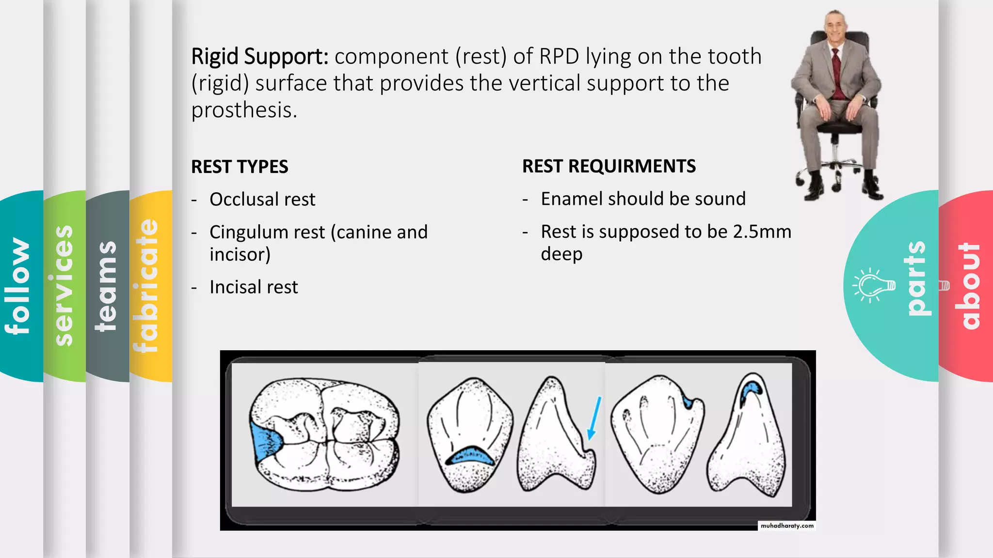 Parts of Removable Partial Denture by FARYAL SAEED ABDAL | PDF