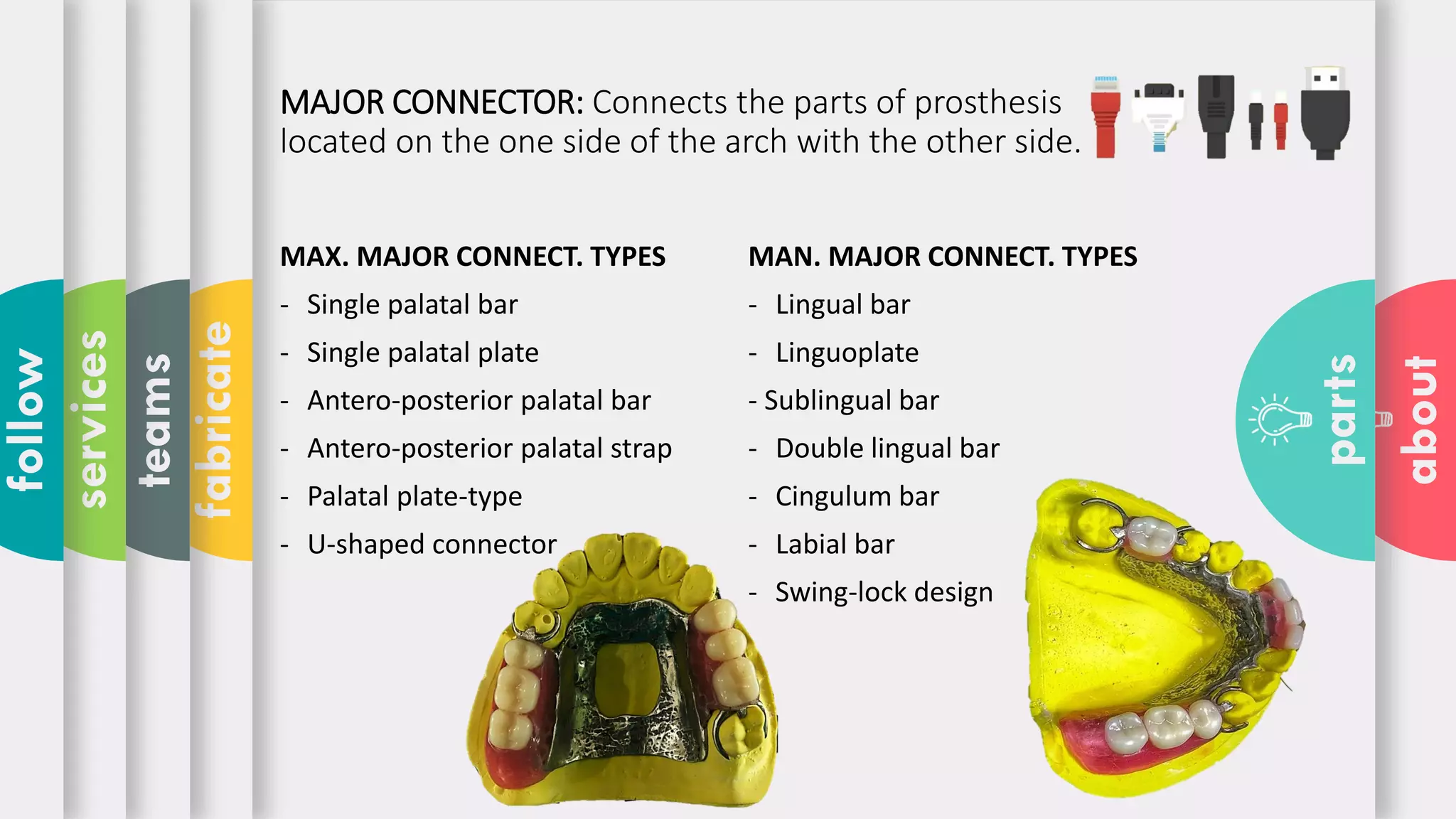 Parts of Removable Partial Denture by FARYAL SAEED ABDAL | PDF