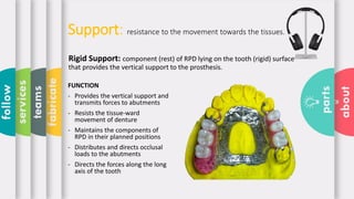 Parts of Removable Partial Denture by FARYAL SAEED ABDAL | PPT