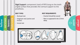 Parts of Removable Partial Denture by FARYAL SAEED ABDAL | PPT