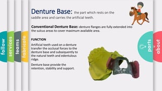 Parts of Removable Partial Denture by FARYAL SAEED ABDAL | PDF