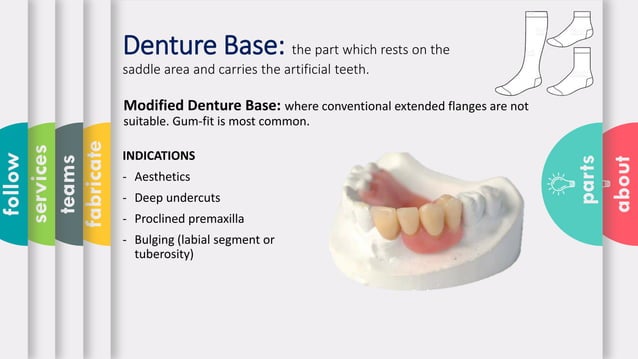 Parts of Removable Partial Denture by FARYAL SAEED ABDAL | PPT