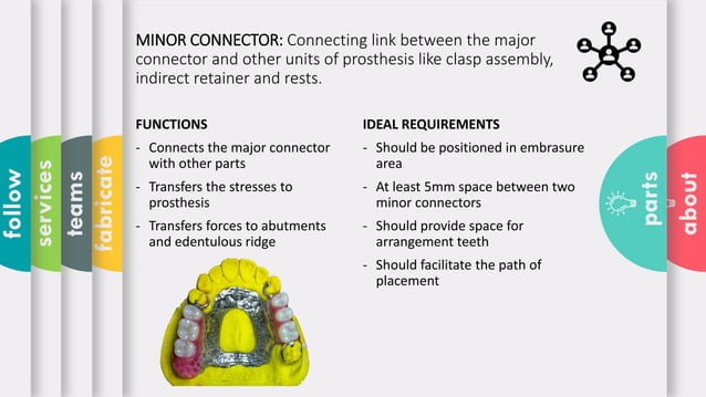 Parts of Removable Partial Denture by FARYAL SAEED ABDAL | PPT