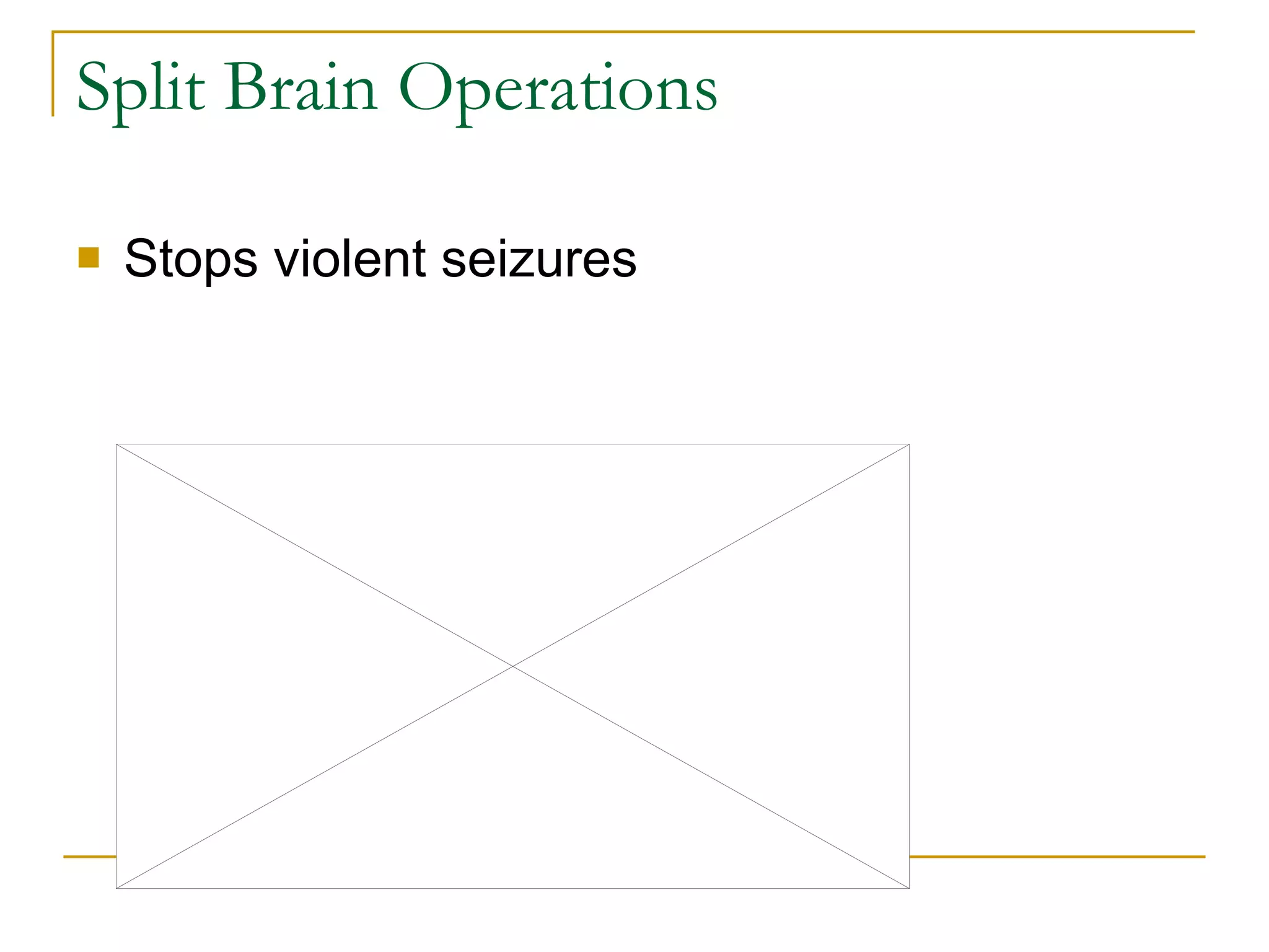 Parts of the brain | PPT