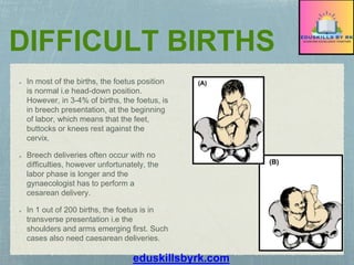 PARTURITION | PPTX | Pregnancy | Reproductive Health