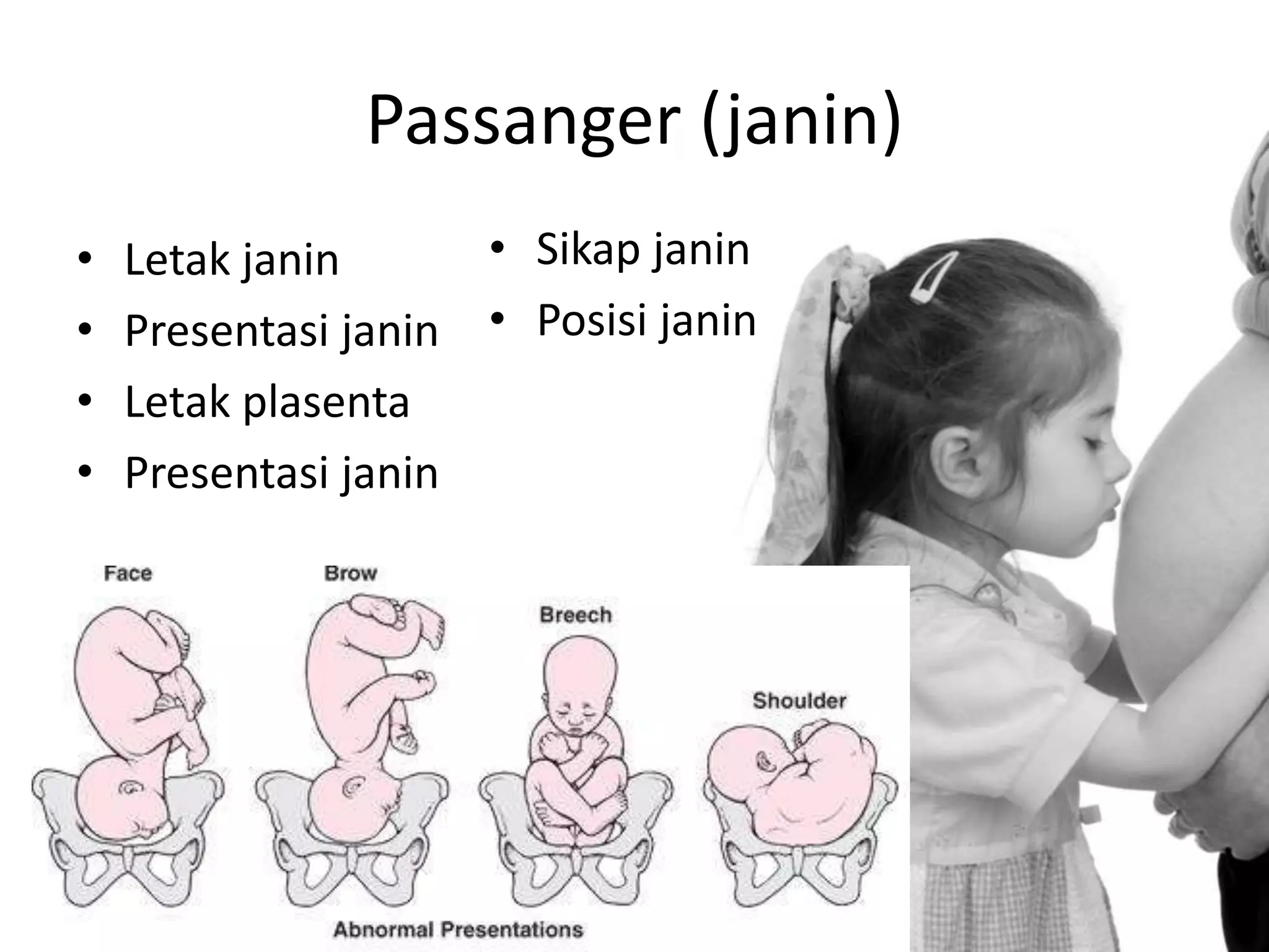 Partus lama Ibu | PPTX